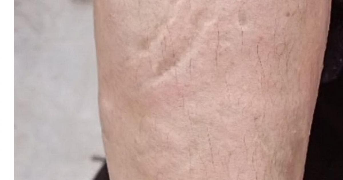 ‘Adiós guapa’, gritan a una mujer mientras le lanzan ácido | Diario de ...